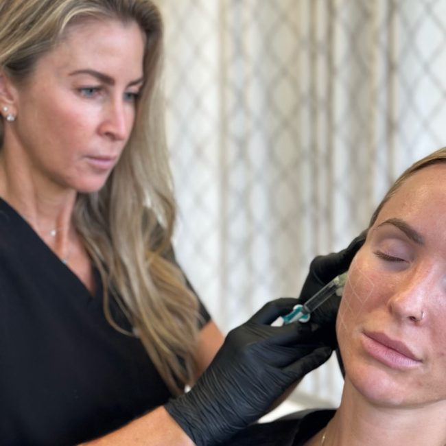 SkinVive - Facial Filler, Injectable Moisturizer, San Juan Capistrano